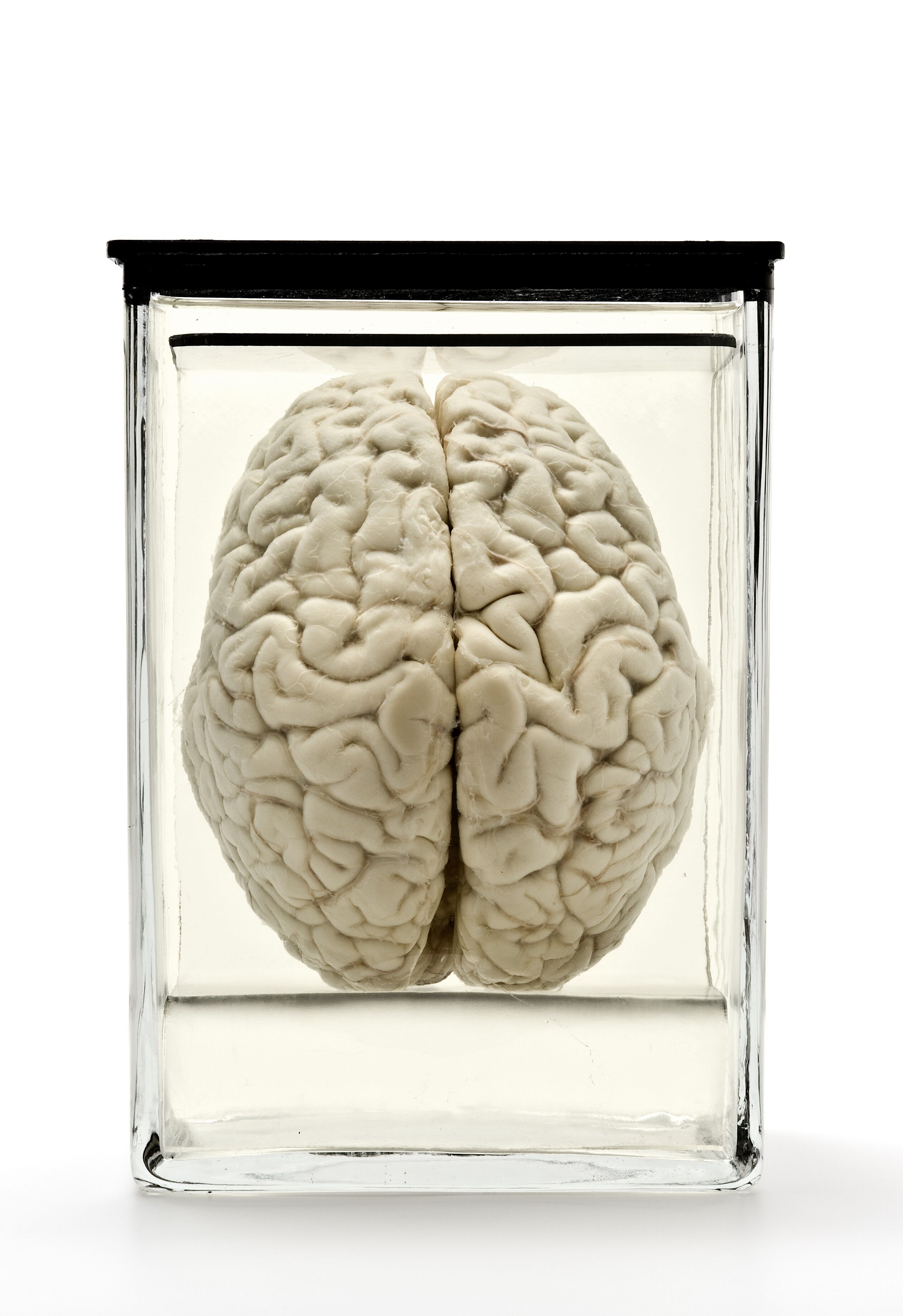 About the museum | bmm – Berliner Medizinhistorisches Museum der Charité